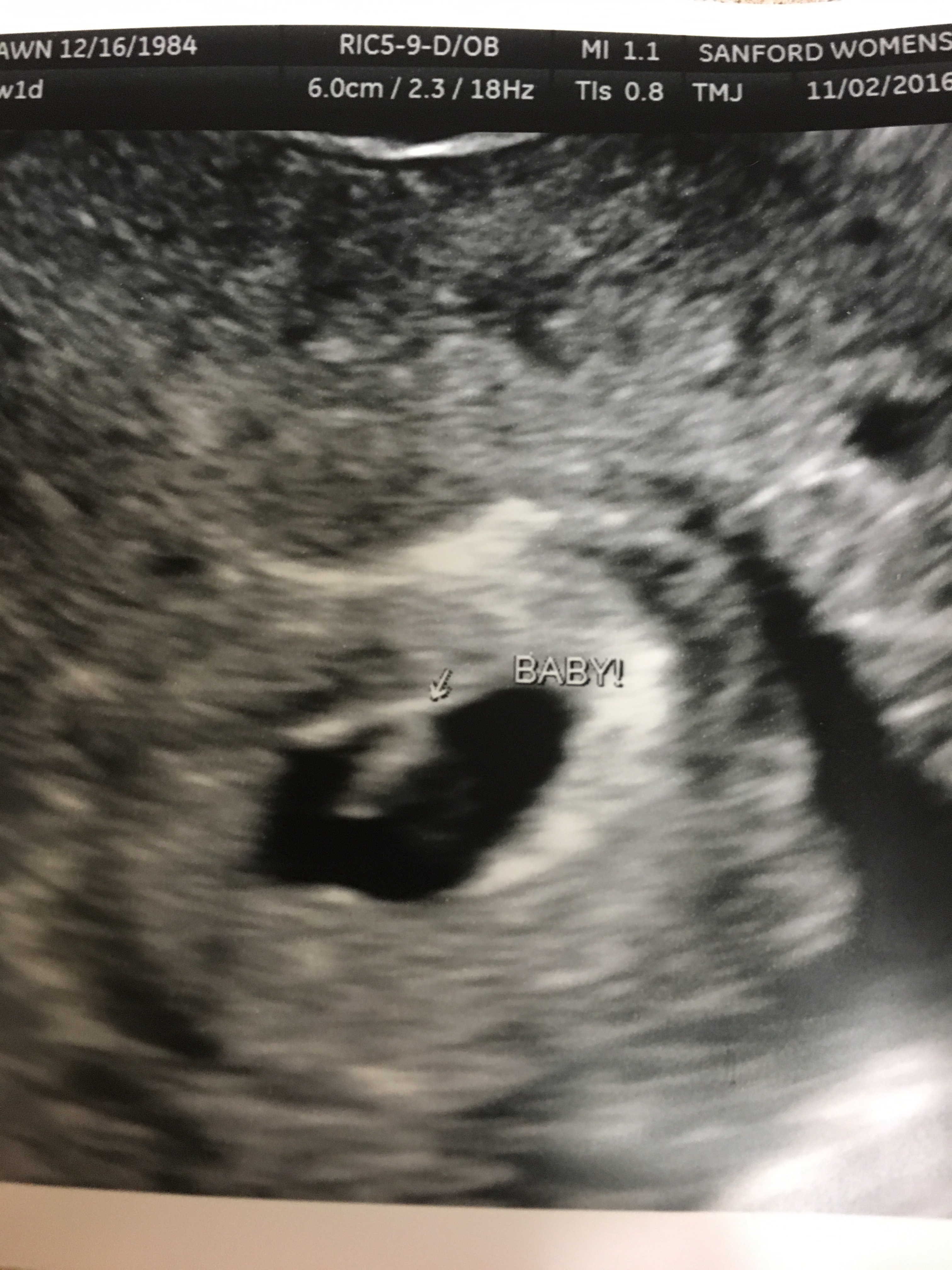 6 Weeks and Counting… – Becoming Mommy